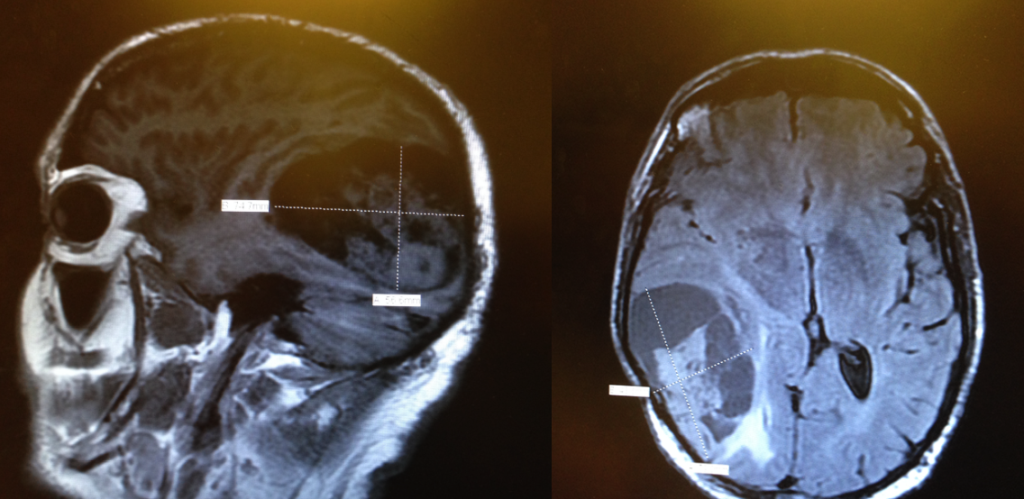 Brain Damage - The Santa Barbara Independent